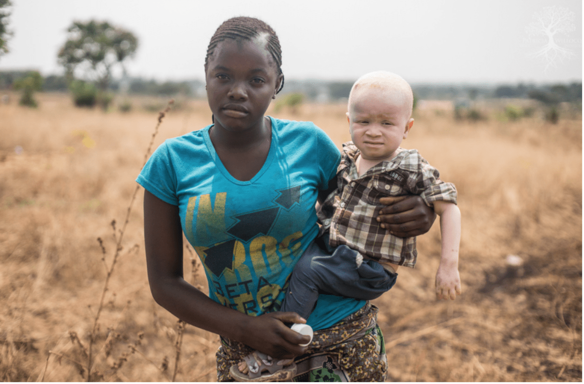 Mothering and Albinism: Public Forum in Pretoria, South Africa ...