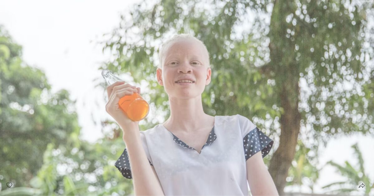 Mothering and Albinism Network’s submission to the World Health ...